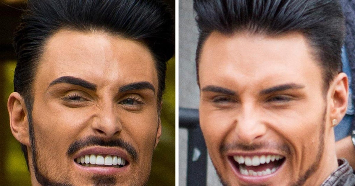 Rylan Clark Debuts New Teeth On 'Big Brother's Bit On The Side ...
