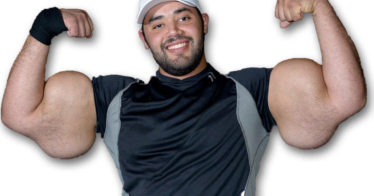 Moustafa Ismail Egyptian Bodybuilders 31 Inch Popeye Biceps Earn A Place In Guinness Book Of
