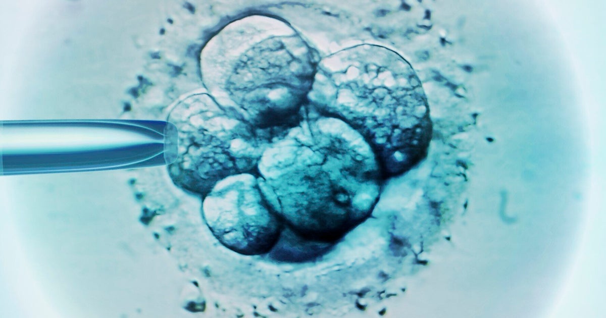 Artificial Intelligence Boosts Pregnancy Success Rates By 30-40% ...