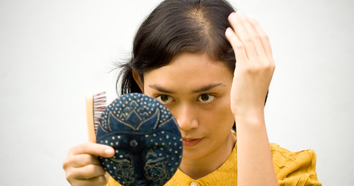 Living With Trichotillomania; When Hair Pulling Takes Over Your Life ...