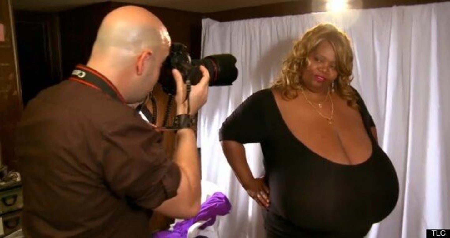 Norma Stitz, Annie Hawkins-Turner, 102ZZZ Breasts Each Weigh More Than A Four-Year-Old Child ...