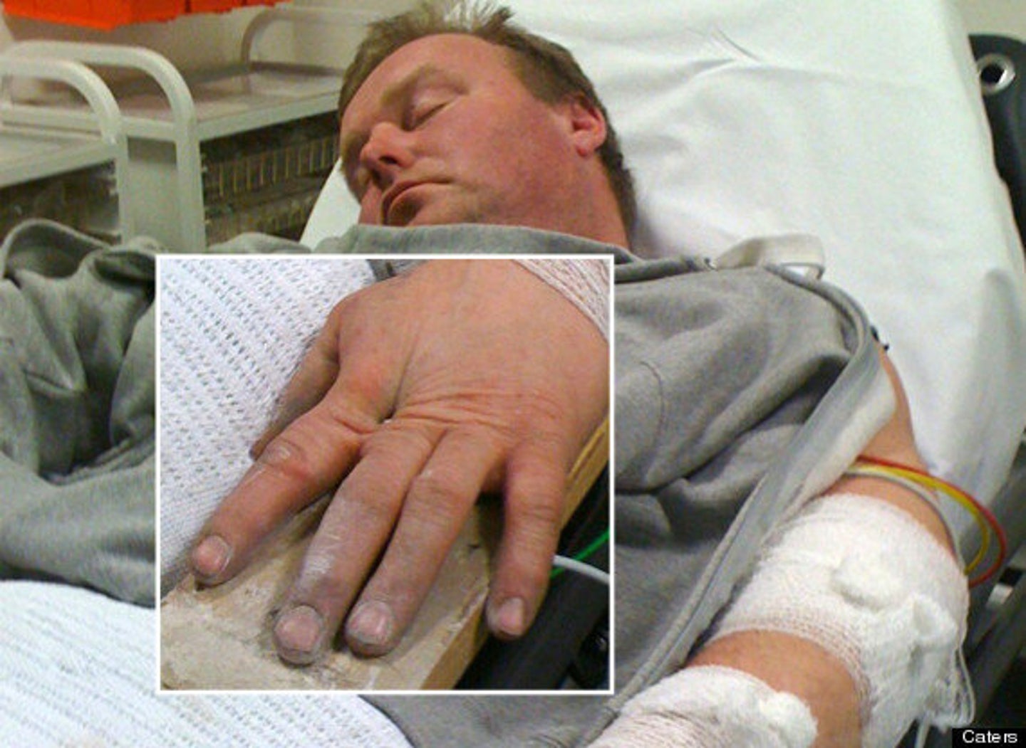 Builder Alan Williams Nails Hand To The Ground In DIY Disaster (PICTURE ...