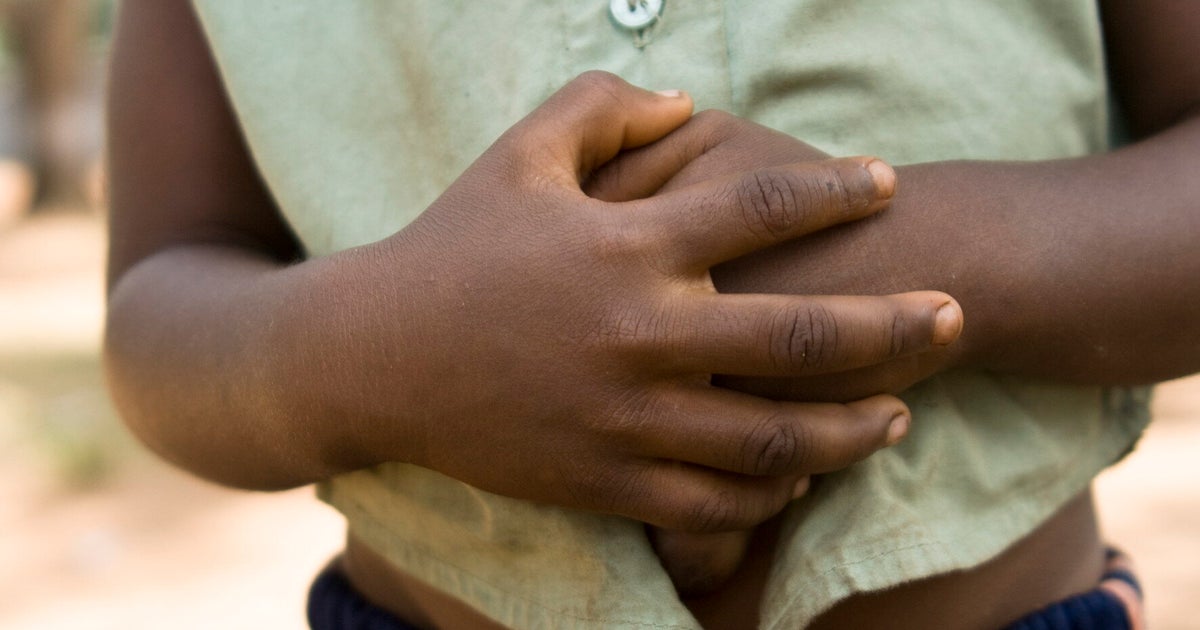129million Children Will Still Find Their Physical and Mental ...
