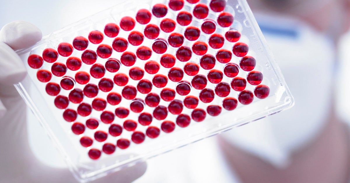 Bloodwise: Beating Blood Cancer | HuffPost UK News