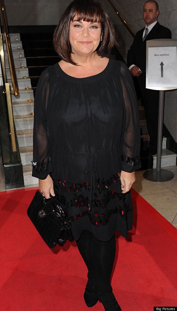 Dawn French's Weight Loss Continues As She Shrinks Before Our Eyes ...