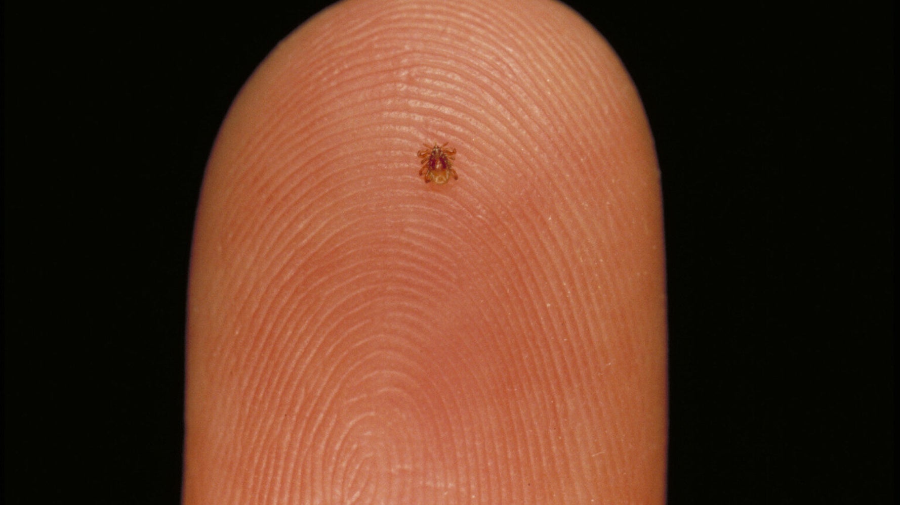 Lyme Disease - Just A Minor Bite Or A Major Epidemic? | HuffPost UK Life