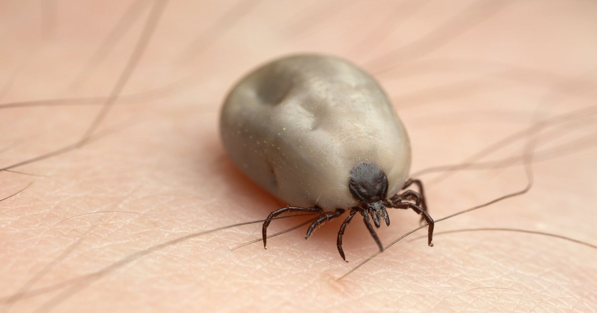 Tick Awareness Month - Top Tips For Tick Prevention | HuffPost UK Life