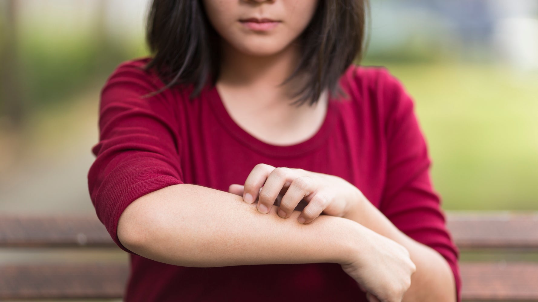 How To Identify A Rash With 9 Simple Questions HuffPost Null how-to-identify-a-rash-with-9-simple-questions-huffpost-null