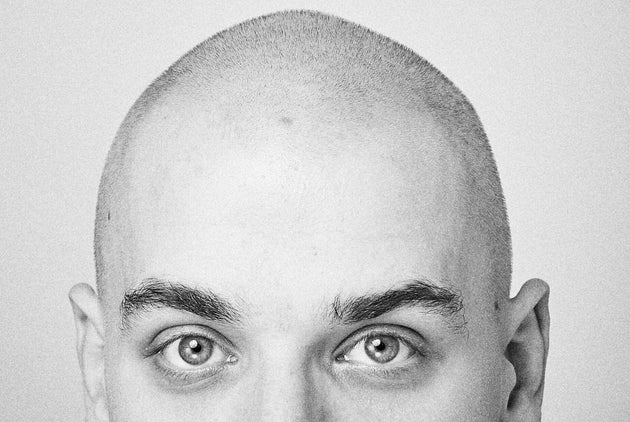 Critical Breakthrough In Cure For Baldness Discovered By Scientists