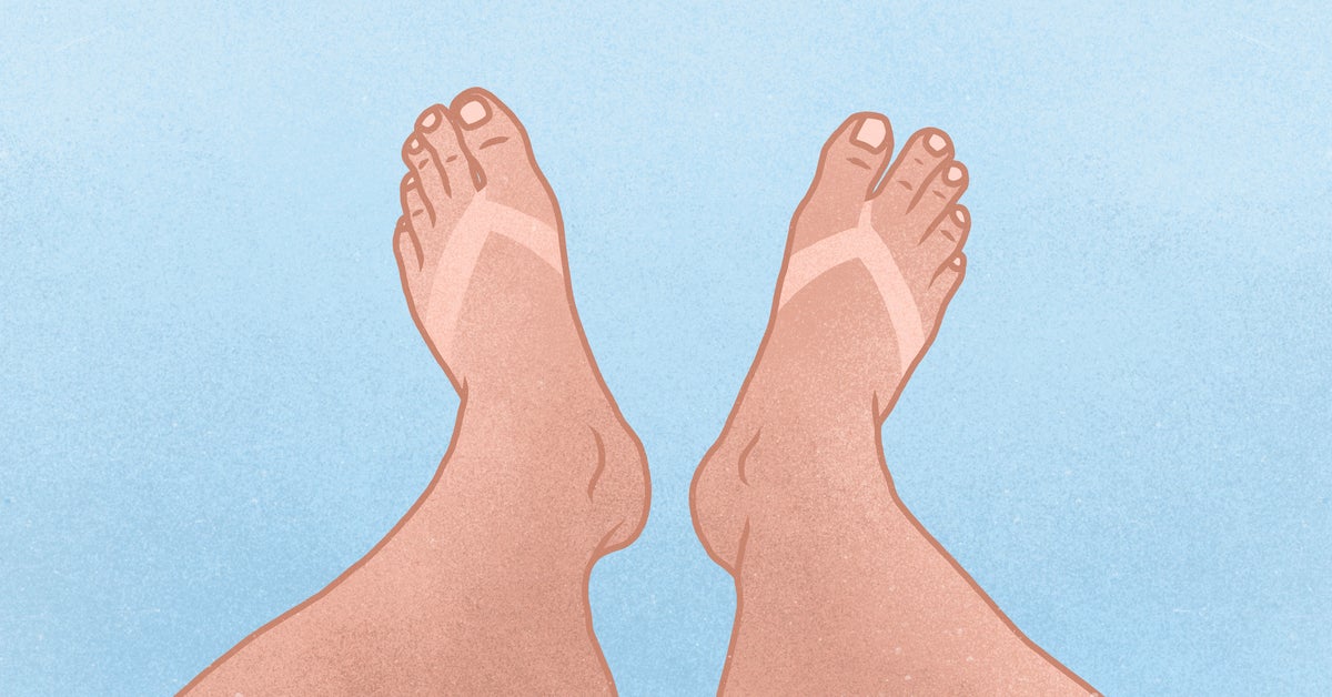 How To Prevent And Treat Sunburn, As Heatwave Sweeps Europe | HuffPost ...