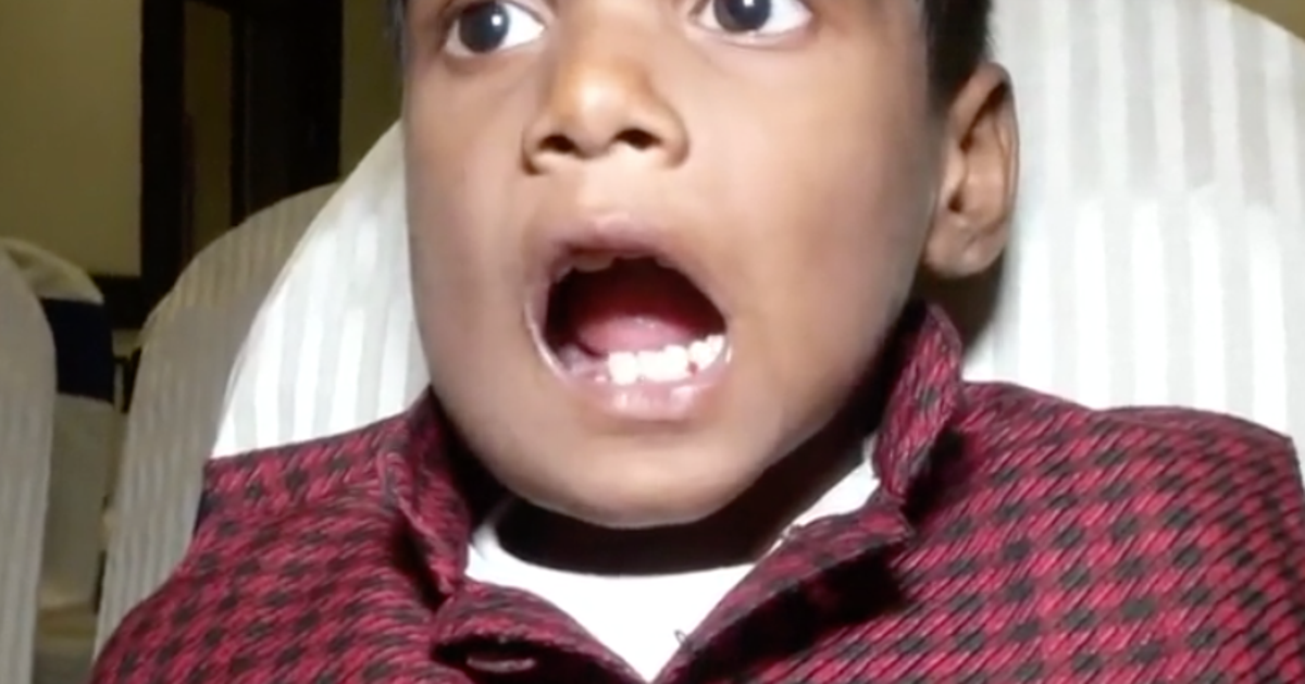 Cluster Of 526 Teeth Removed From Seven-Year-Old Boy’s Mouth | HuffPost ...