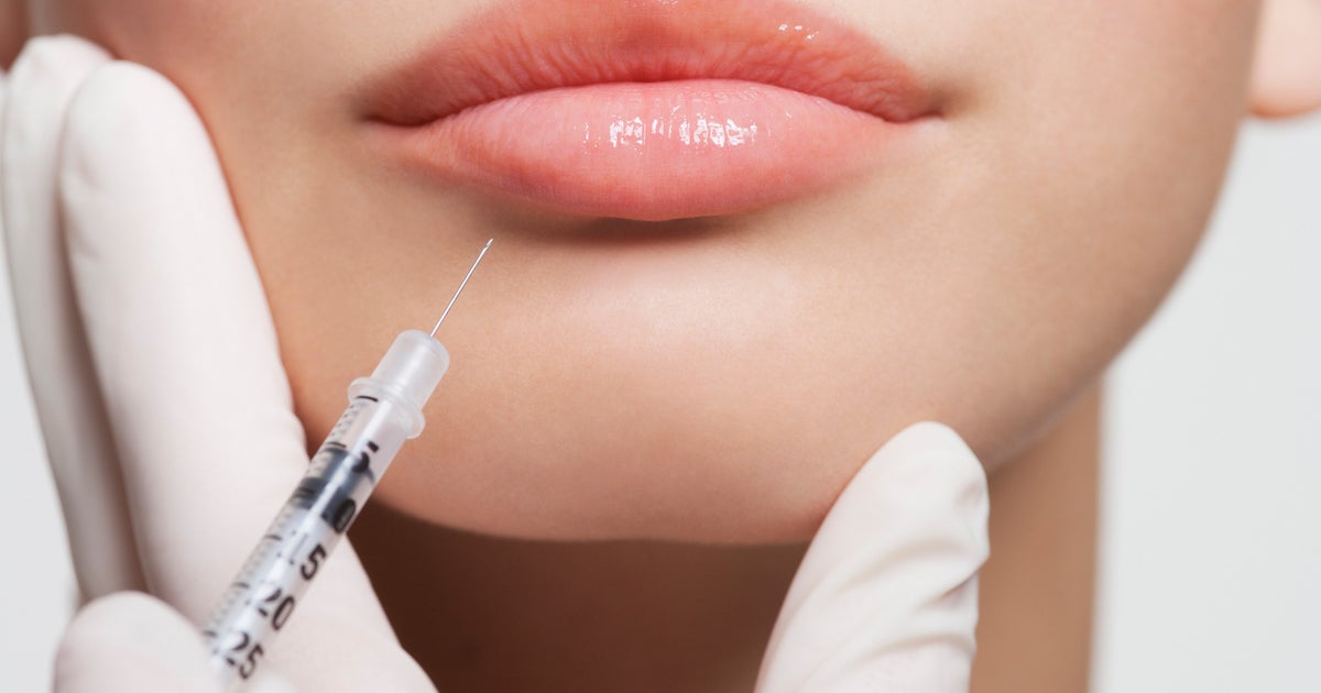 My Life After Botched Groupon Lip Fillers | HuffPost Life