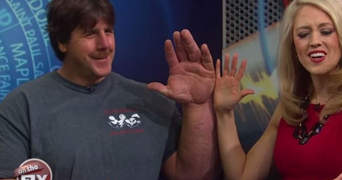 Jeff Dabe: Η ιστορία του άνδρα με τα γιγάντια χέρια | HuffPost Greece ...