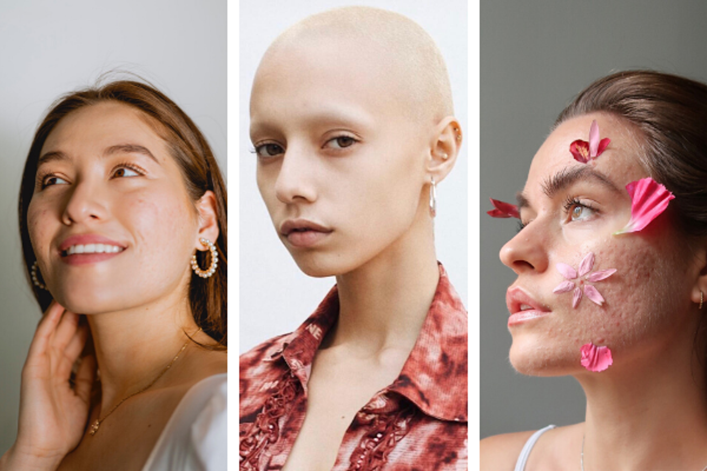 12 People Share Why They're Grateful For Their Unconventional Looks ...