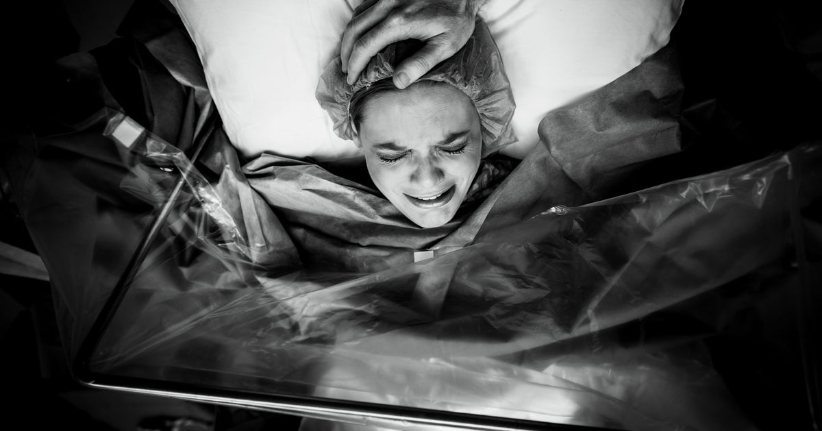These Raw Photos Show The Beauty Of C-Section Birth | HuffPost UK Parents