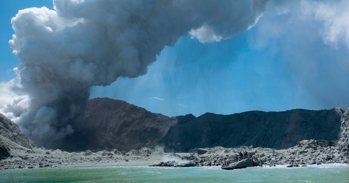 White Island: Doctors Treating Volcano Burns Victims Await 1.2m Square ...