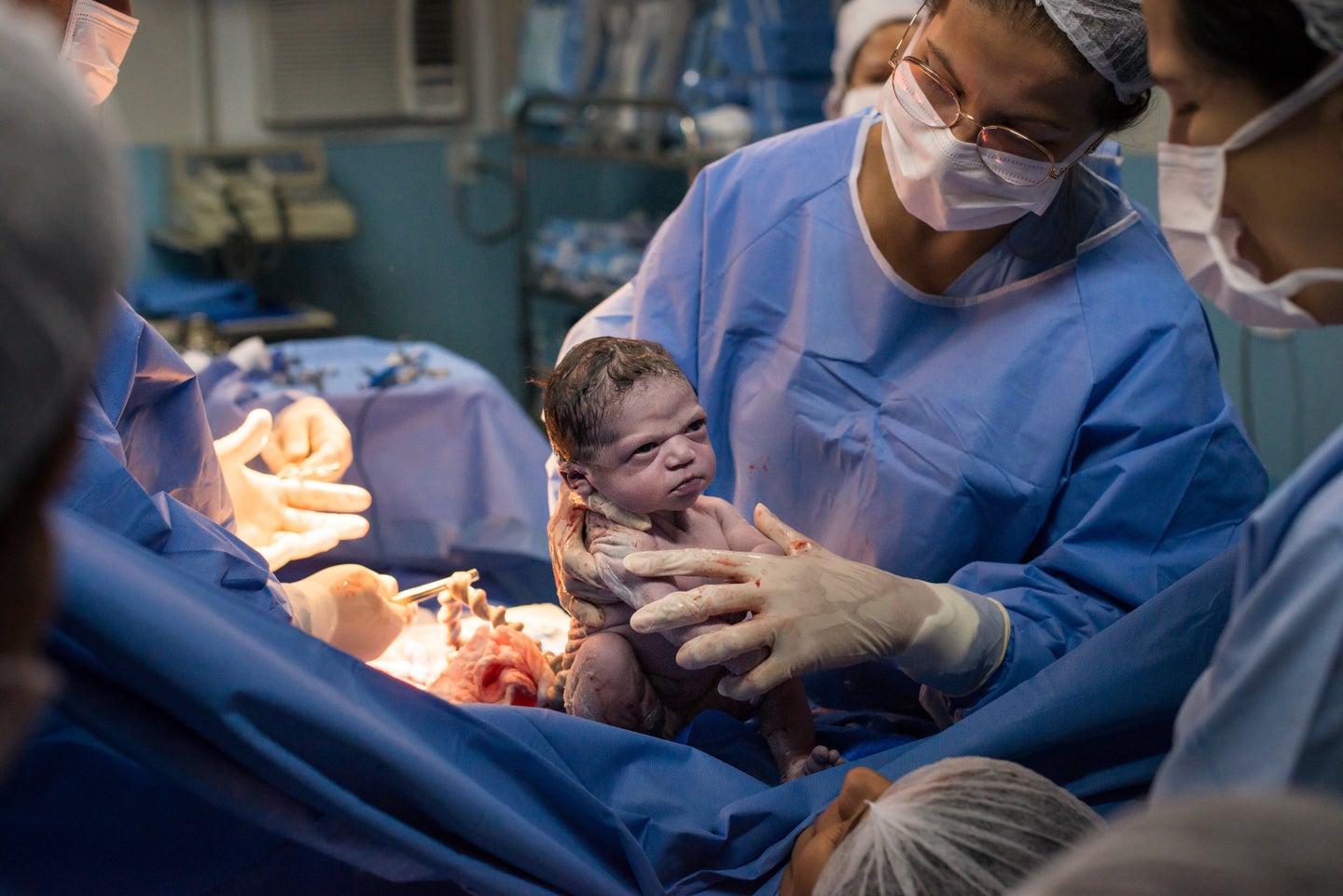 Newborn Baby Makes Epic Face In Viral Birth Photo | HuffPost Life