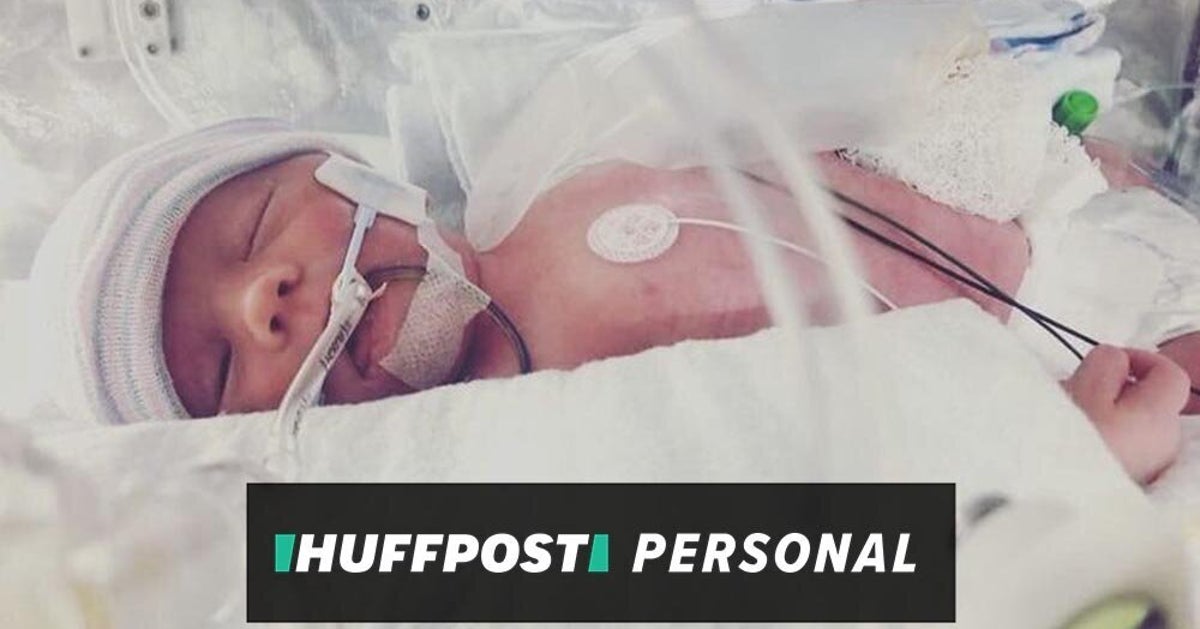 My Baby's Intestines Fell Out. Here's What I Wish I Had Known ...