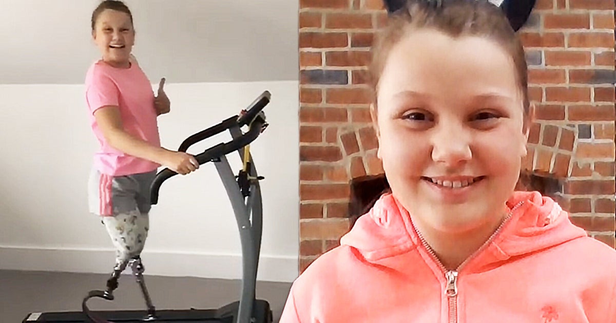 A Minute Of Kindness: Girl Who Lost Her Legs Walks A Marathon At Home ...