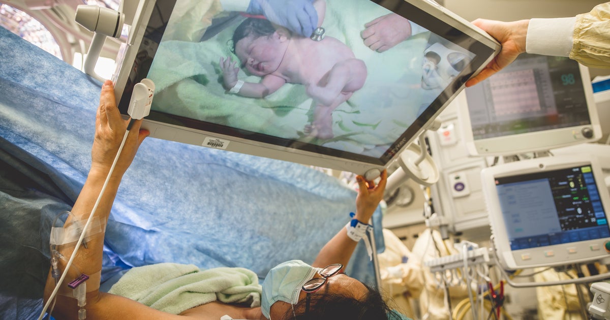 These Stunning Birth Photos Show The Power Of C-Section Moms | HuffPost ...
