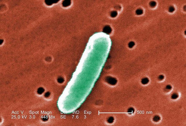 E Coli Outbreak That Sickened 15 Could Be Over, CDC Says | HuffPost Life