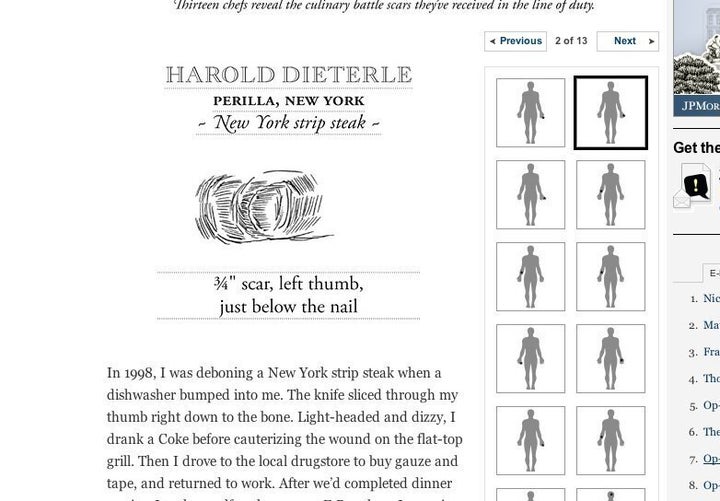 The Stories Behind 13 Chefs' Kitchen Scars | HuffPost Life