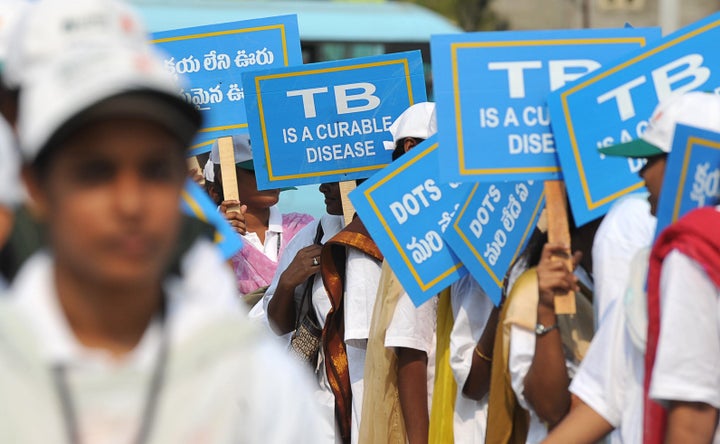 Tuberculosis In America: Who Is Affected? | HuffPost Latest News