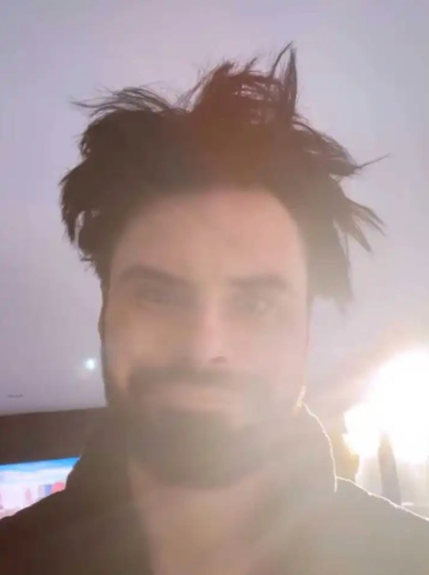 Rylan Clark Shows Off His Brand New Teeth After Getting His Famous ...