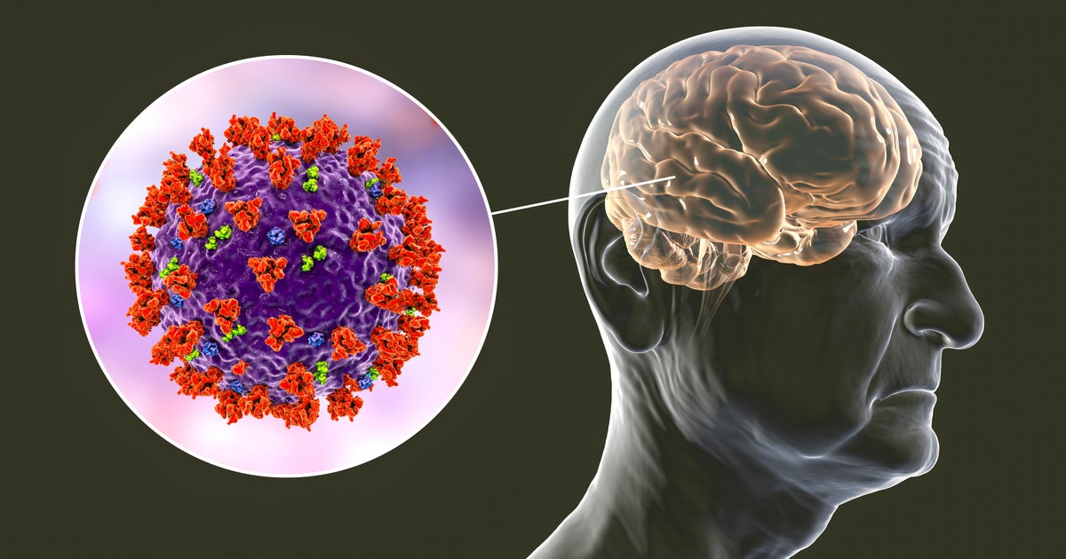 Covid Is Messing With Our Brains, Here's How | HuffPost UK Life