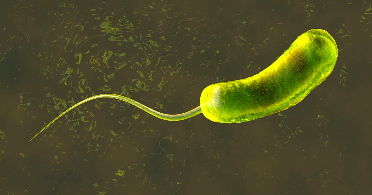 Qué es el cólera y cuáles son sus síntomas y tratamiento | El HuffPost Life