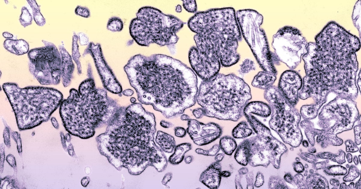 Langya: Νέος ιός με δεκάδες κρούσματα στην Κίνα | HuffPost Greece ΔΙΕΘΝΕΣ