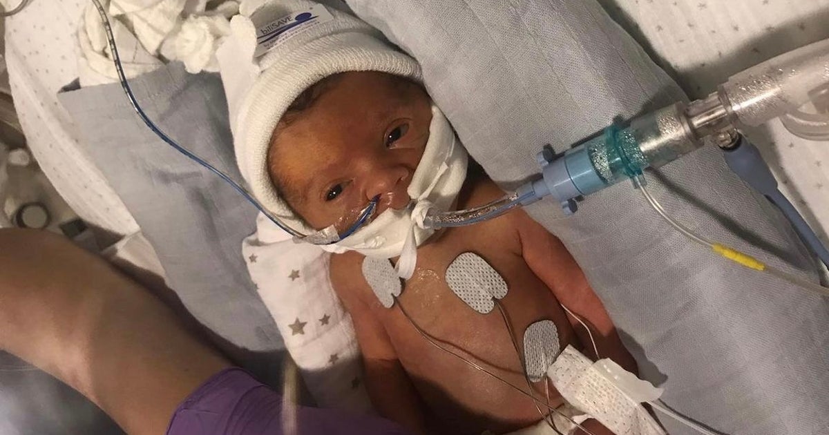 Our Babies Were Born Prematurely. This Is What We Want You To Know ...
