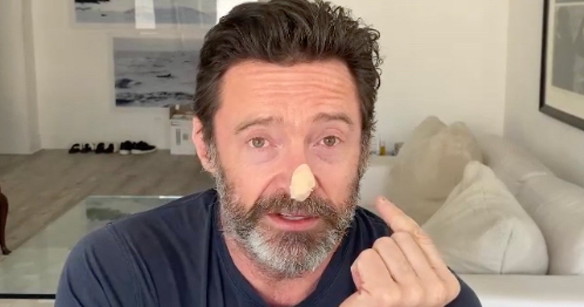 Hugh Jackman Reveals Skin Cancer Biopsies With Nose Bandaged Sunscreen
