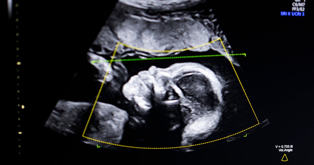 What To Expect At Your 12-Week Baby Scan | HuffPost UK Life