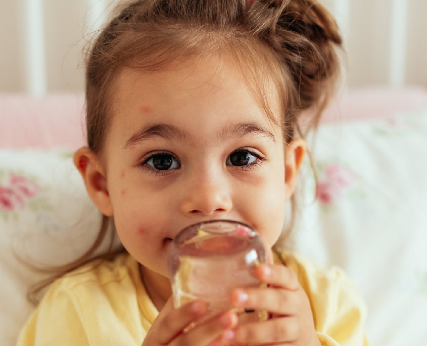 The One Painkiller You Should Never Give To Kids With Chickenpox ...
