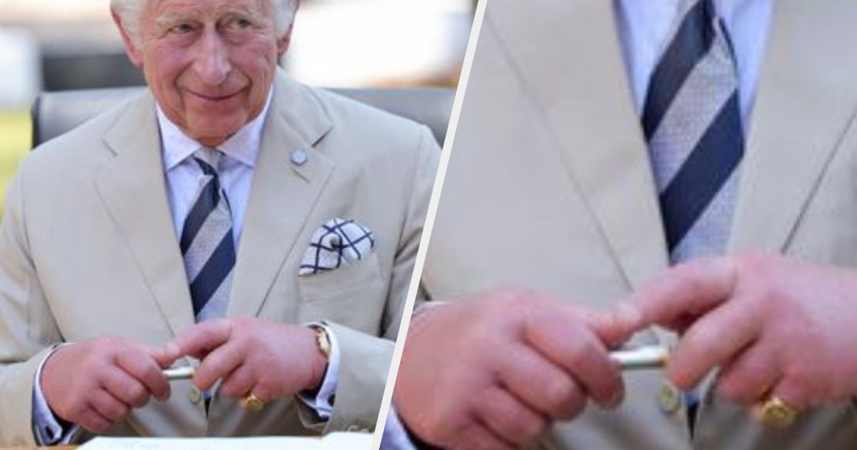 King Charles' Massive 'Sausage' Fingers Explained By Doctor | HuffPost ...