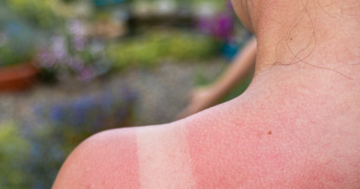 10 Red Flag Signs You Need To Get Out Of The Sun ASAP | HuffPost UK Life