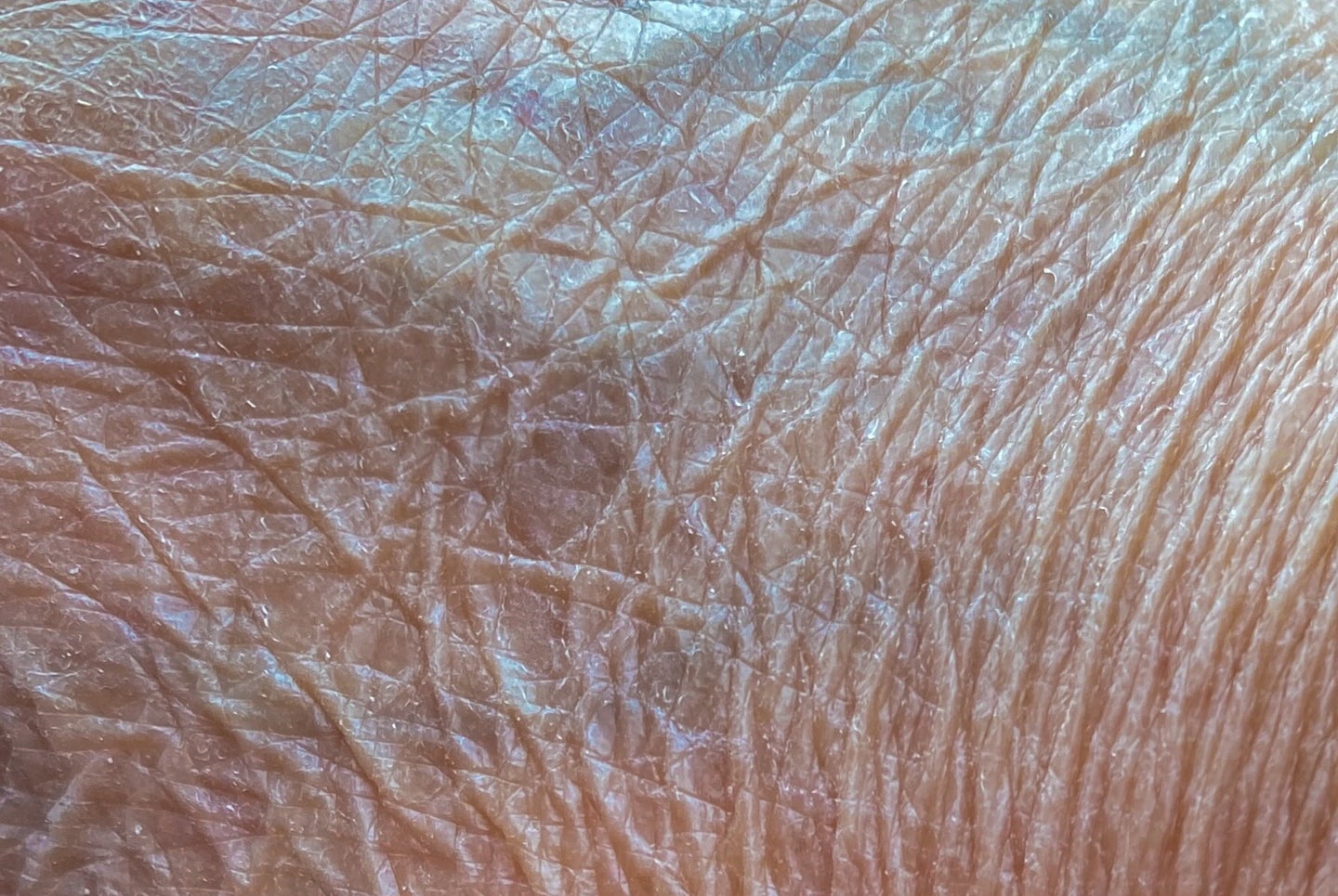 Why Your Skin Gets Crepey As You Age, And How To Treat It | HuffPost Life