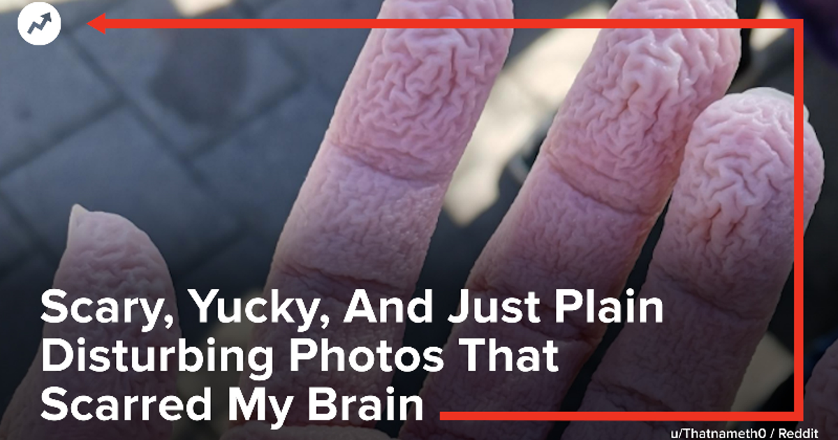 Scary, Yucky, And Just Plain Disturbing Photos That Scarred My Brain ...