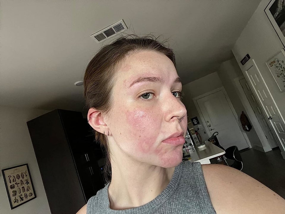 The Tiktok Famous Cosrx Snail Serum Is On Sale This Prime Day