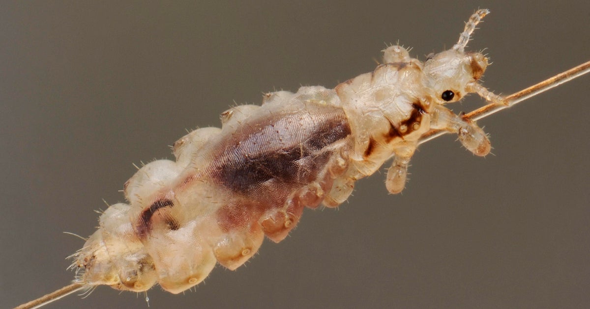 So THAT's The Difference Between Nits And Head Lice | HuffPost UK Parents