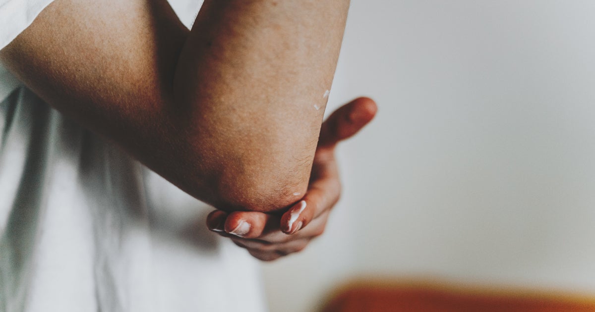 Signs Your Dry Elbows Indicate Serious Health Issues | HuffPost UK Life
