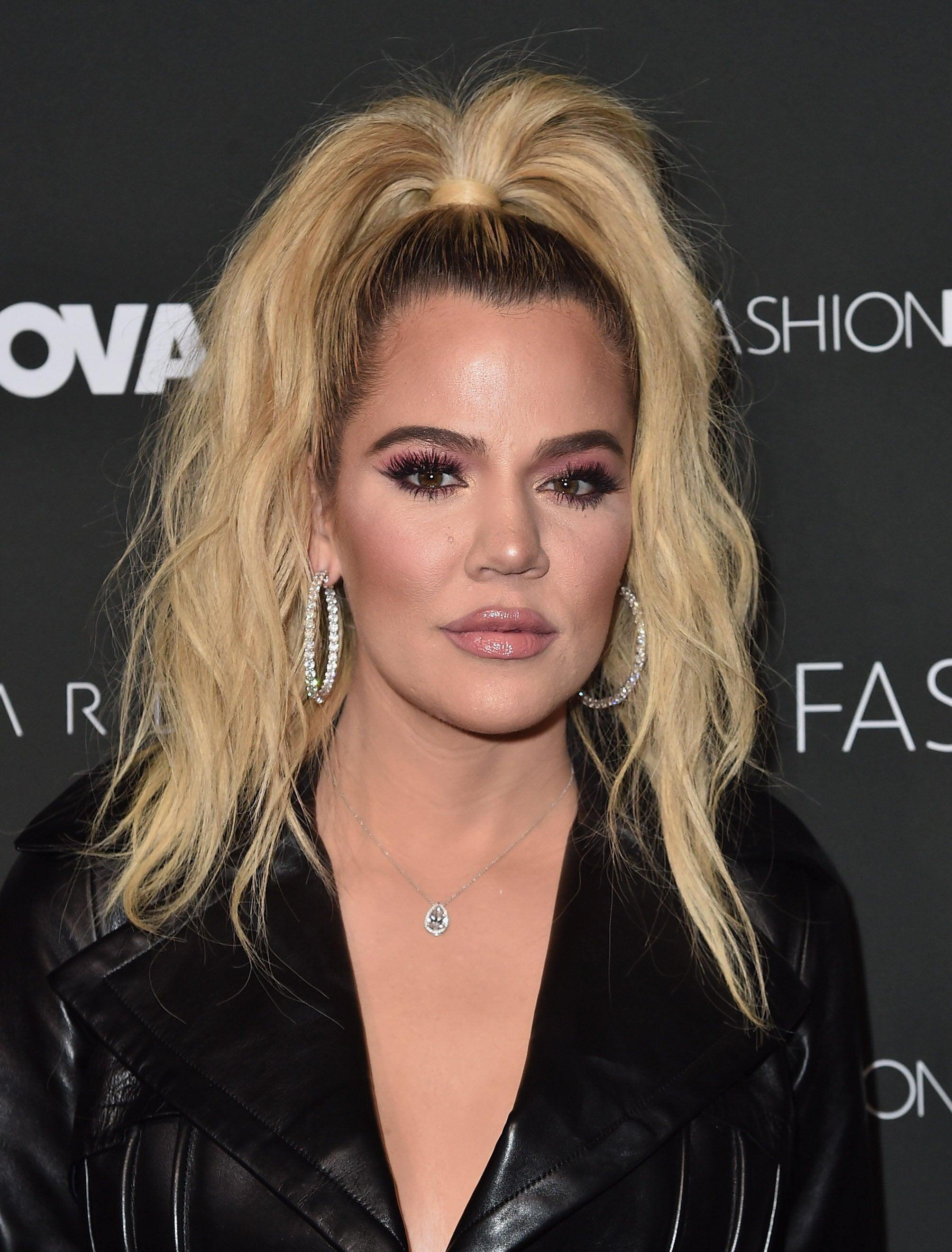 Khloé Kardashian Shares Photos Of 'Huge' Indentation On Cheek After ...