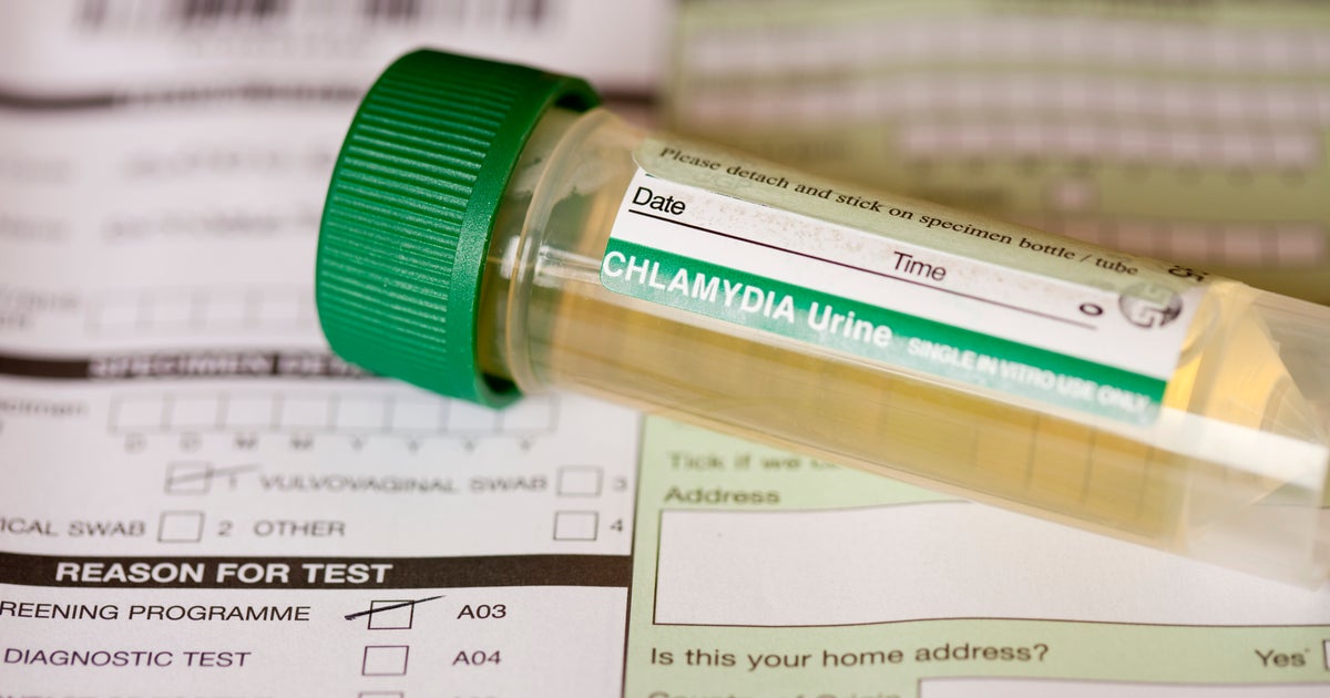 Yes Really – You Can Get Chlamydia In This Body Part | HuffPost UK Life