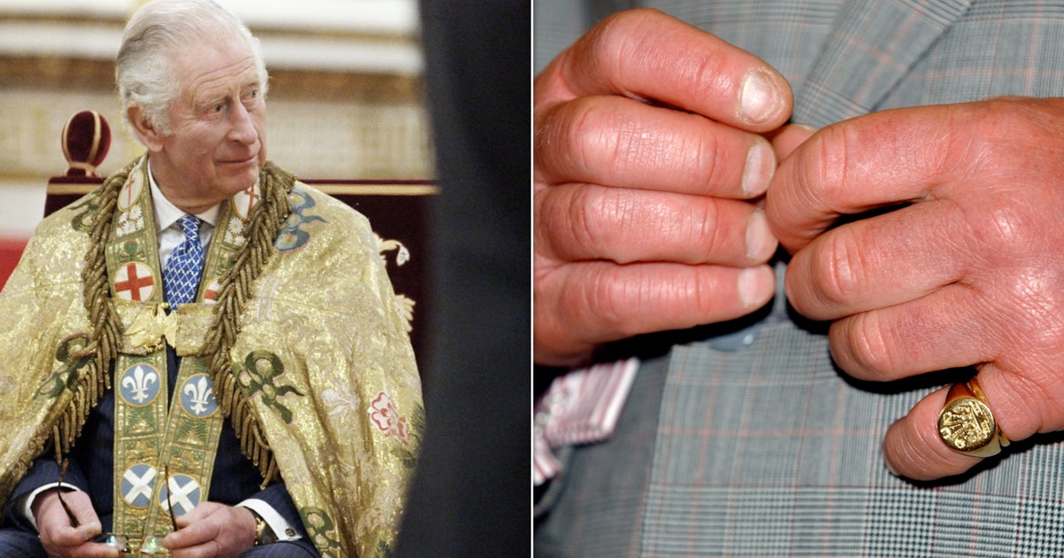 King Charles Is Very Much In On The Sausage Finger Jokes... And Even ...
