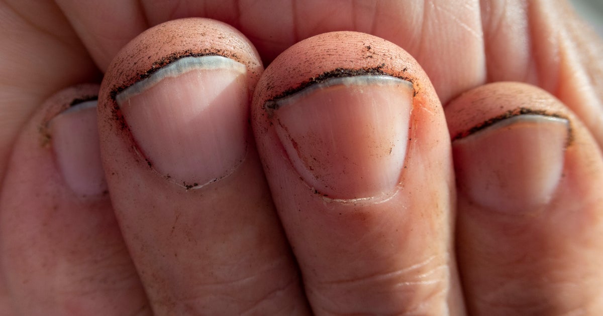 Here's What The Colour Of Your Nail Gunk Means | HuffPost UK Life