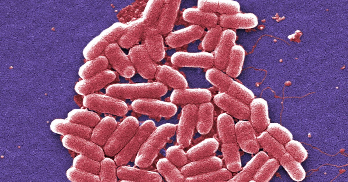 Sepsis Is A Silent Killer, These Are The Symptoms To Look Out For ...