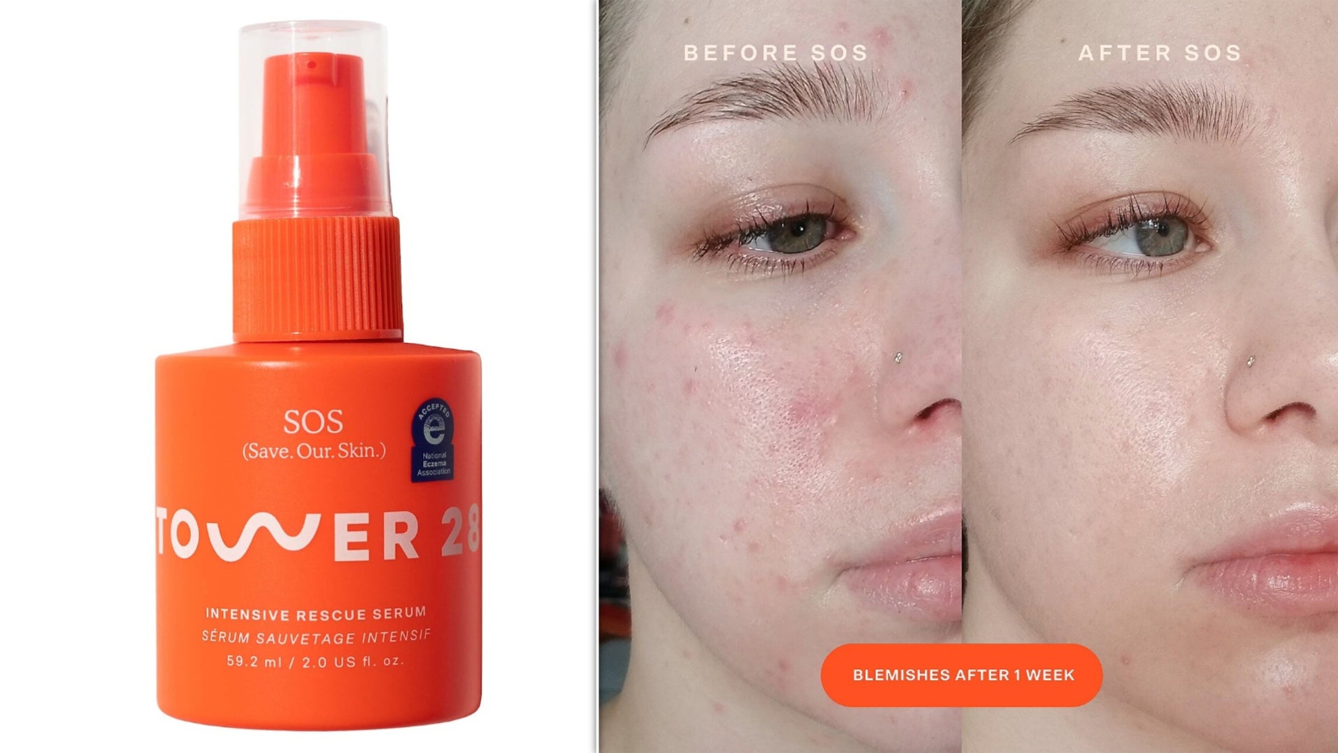 6 Facial Sprays Like Tower28's SOS Rescue Spray | HuffPost Life