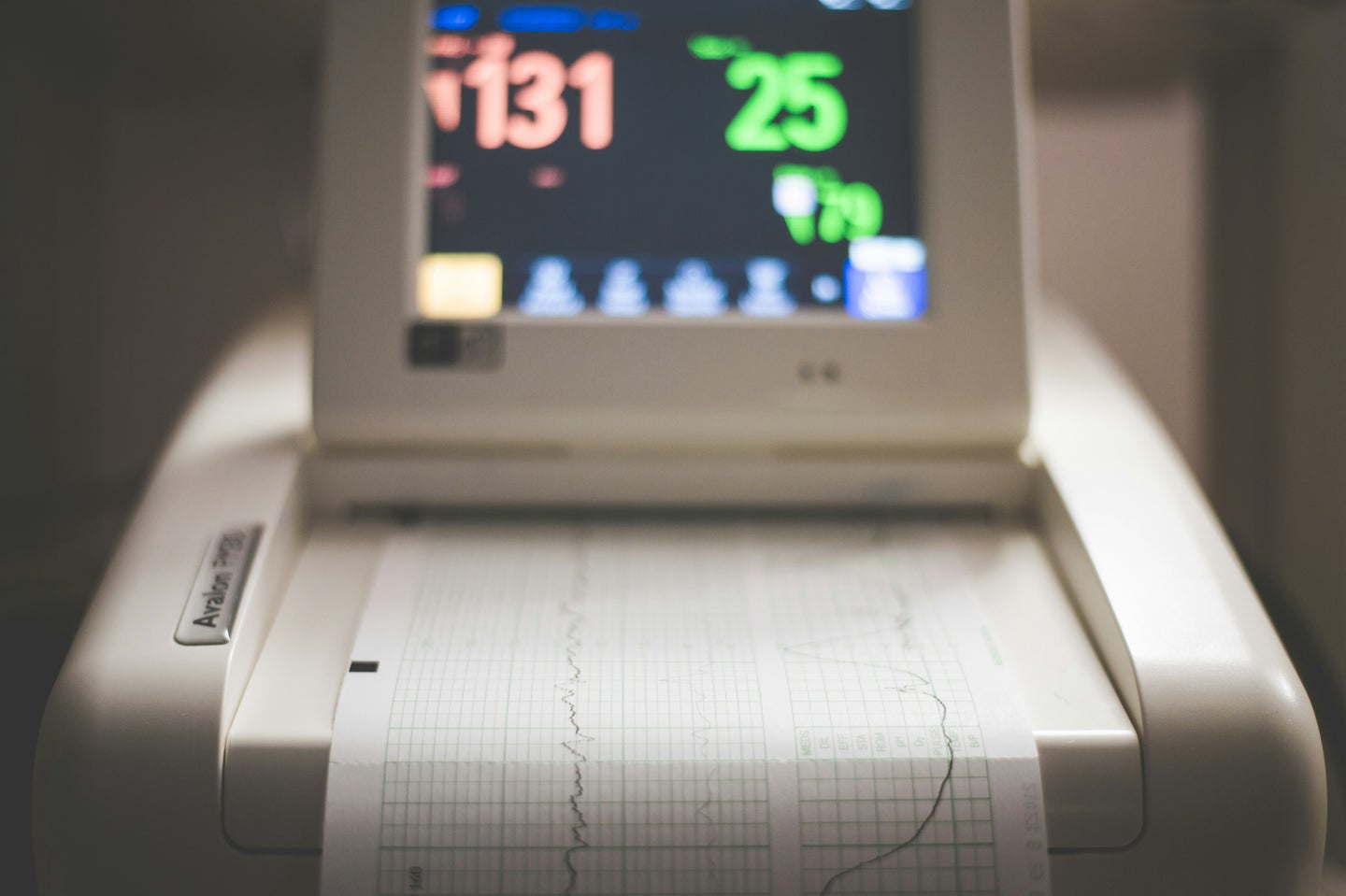 Here's What's Considered 'Good' Heart Recovery Rate By Age | HuffPost ...