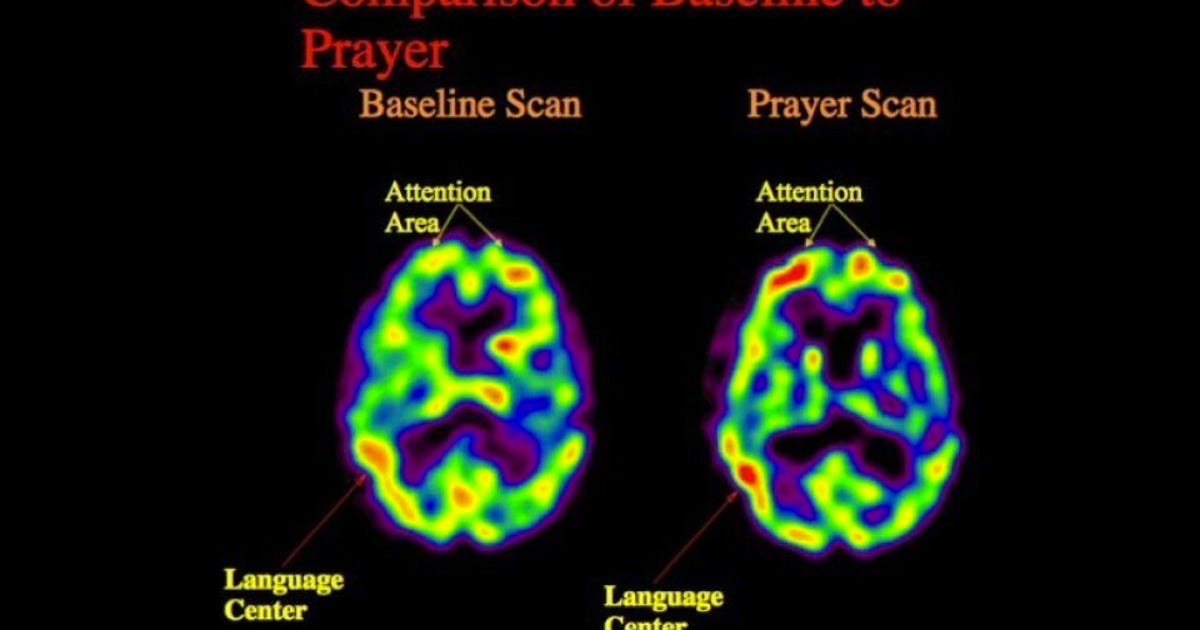 What The Brains Of Praying Nuns Have In Common With Psychedelic Drug ...